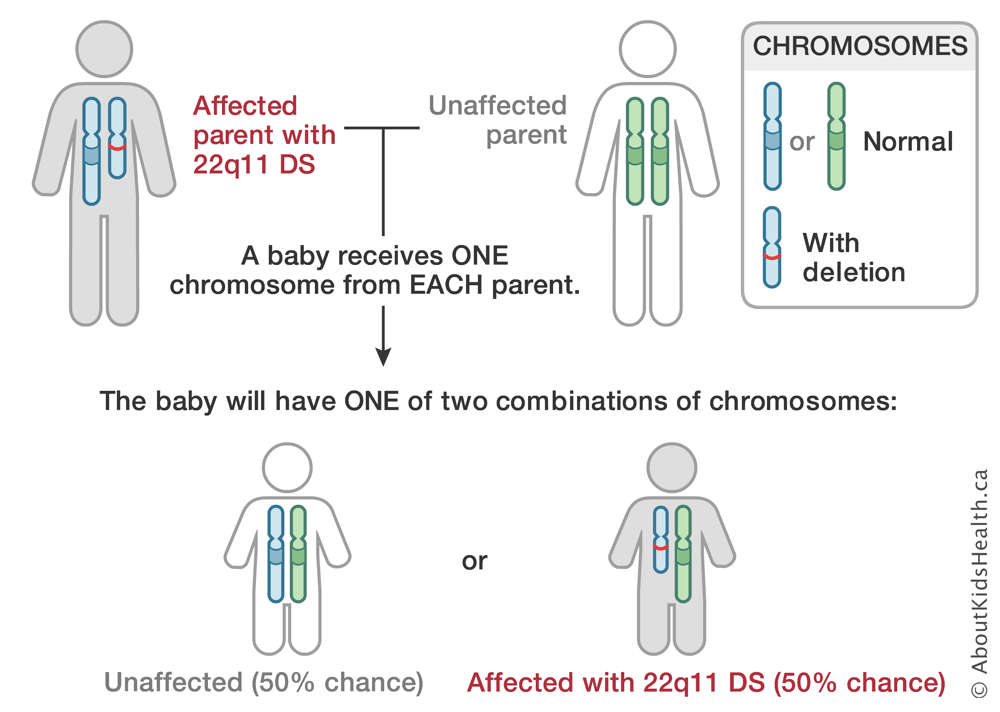 Chromosome 22 Deletion