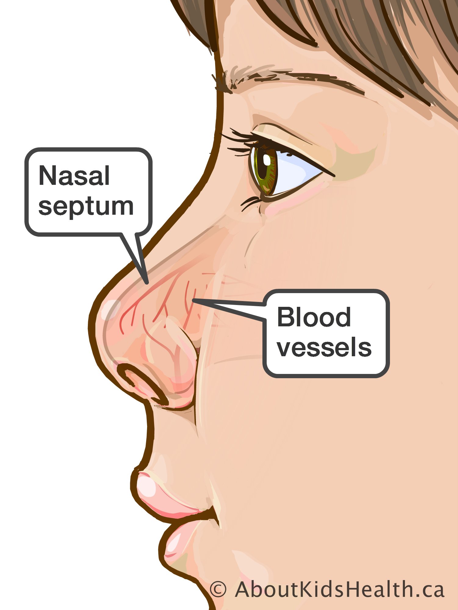 Cauterizing the nose store