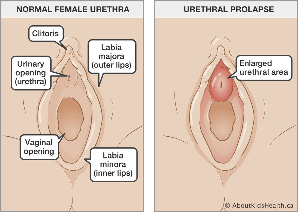 Healthy Female Urethral Opening