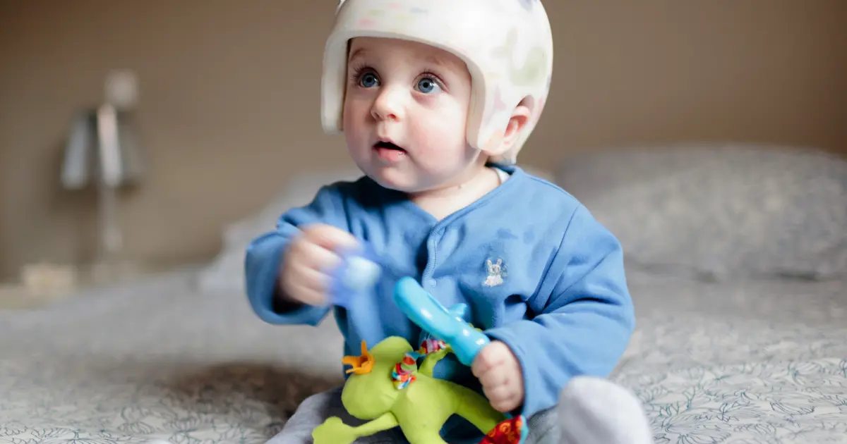 Flat head syndrome (positional plagiocephaly and brachycephaly ...